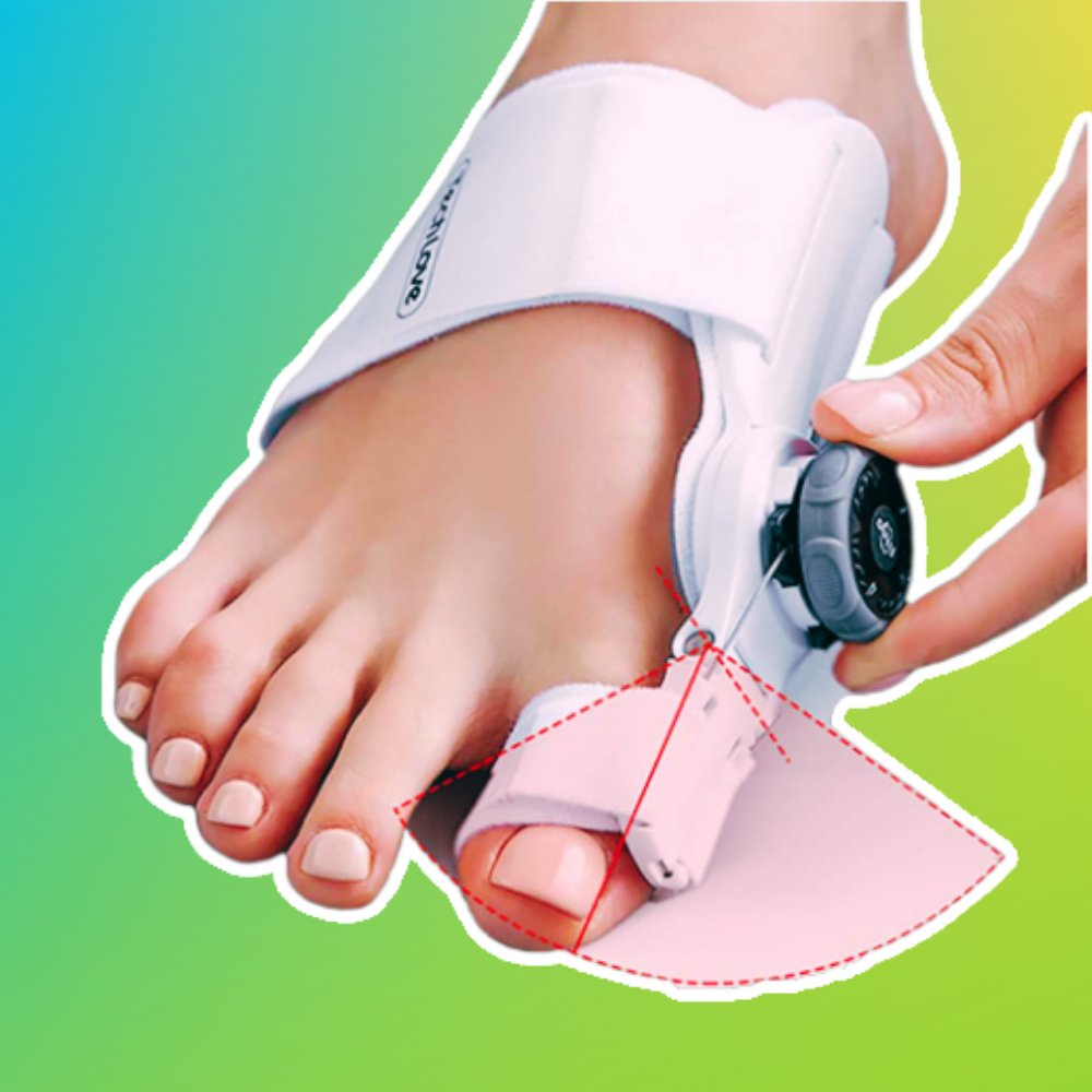 Upgraded Toe Bunion Corrector - 3D Knob Toes Corrector – FOFOPO